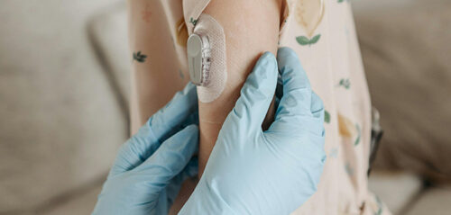 Life-changing diabetes technology transforming care for children and ...